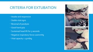 General anesthesia (for INTERNS).pptx