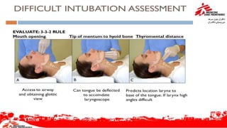 General anesthesia & obstetrics part II | PPTX