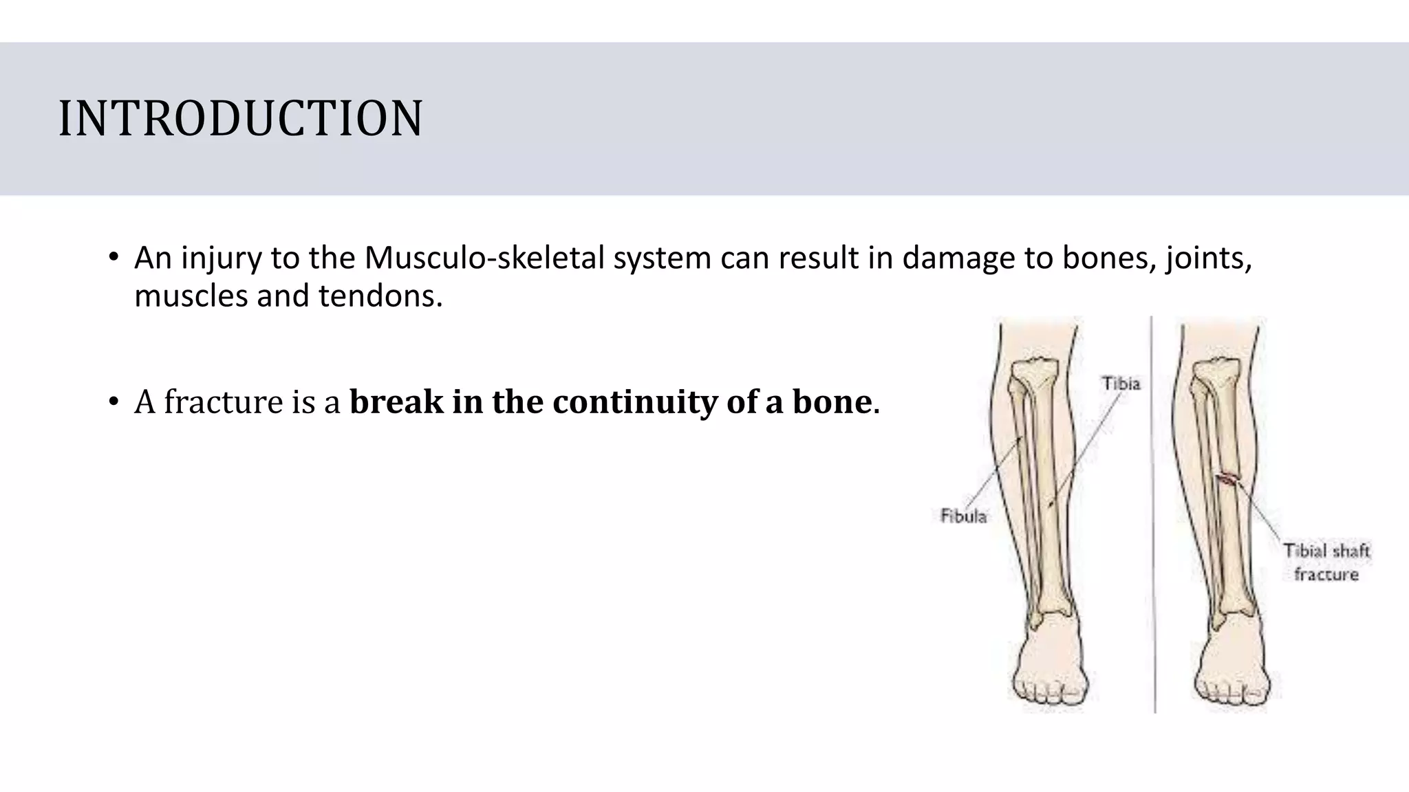 GENERAL ASPECTS OF FRACTURE.pptx | First Aid | Injuries