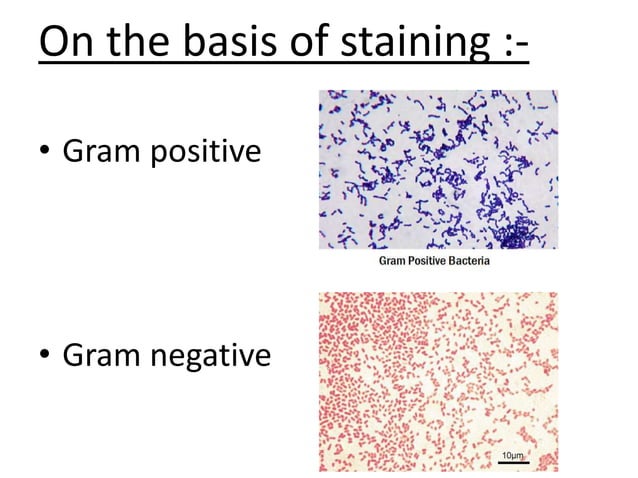 General characters of bacteria and clasification | PPTX | Lung and ...