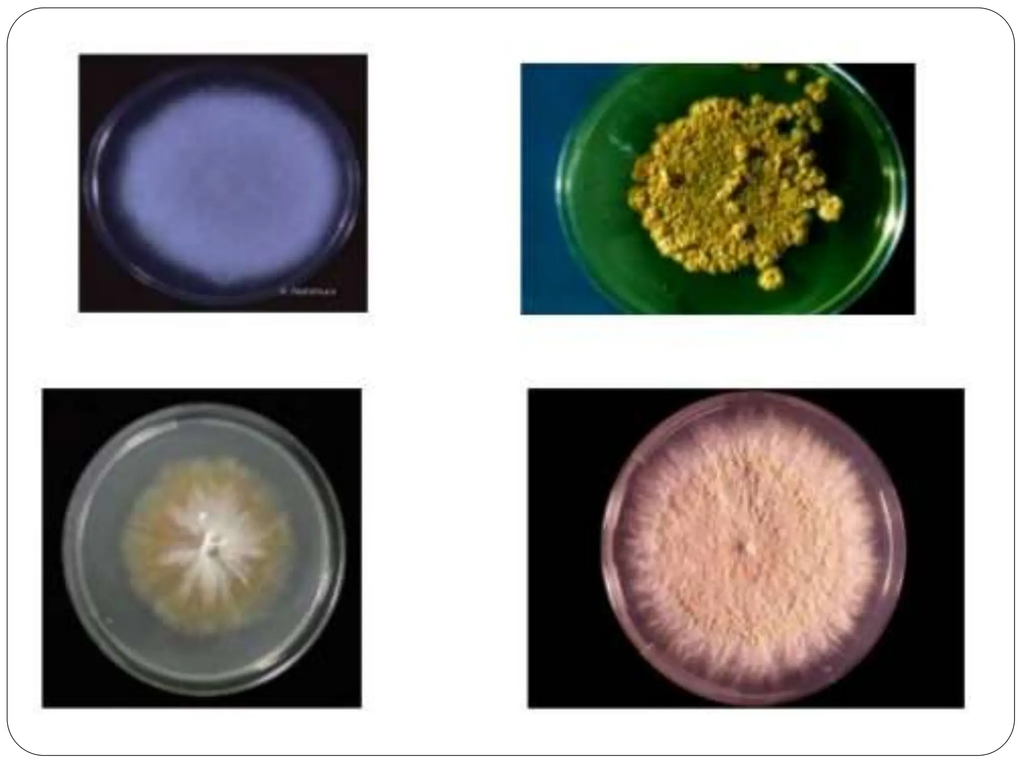 General characters of medically important fungi.pptx