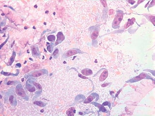 General criteria of malignancy | PDF