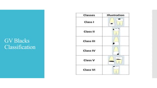 General dentistry & | PPT
