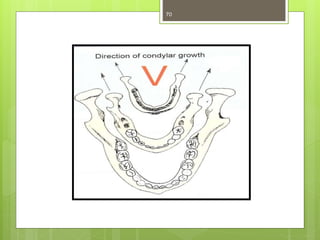 General embryology growth & development of mandible | PPTX