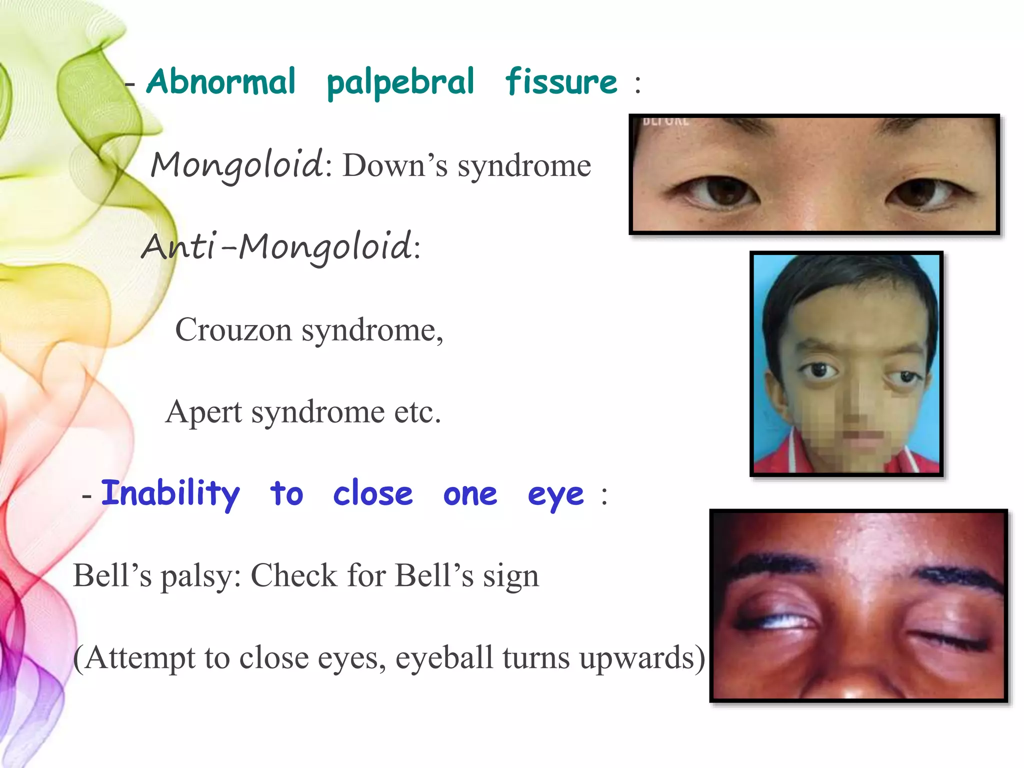 General & extraoral examination.pptx