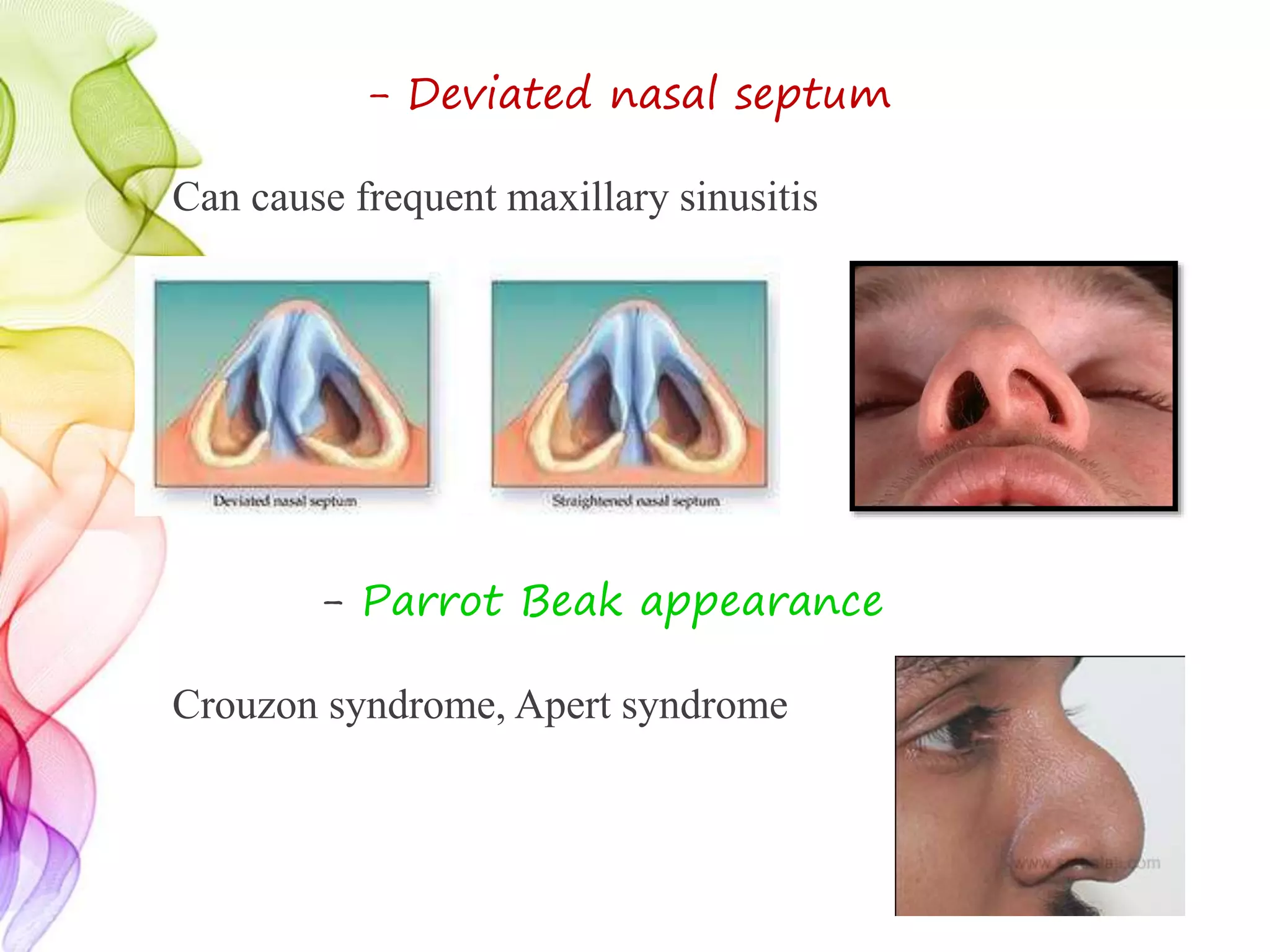 General & extraoral examination.pptx