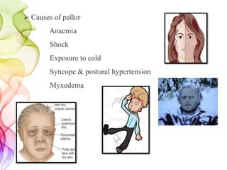 General & extraoral examination.pptx