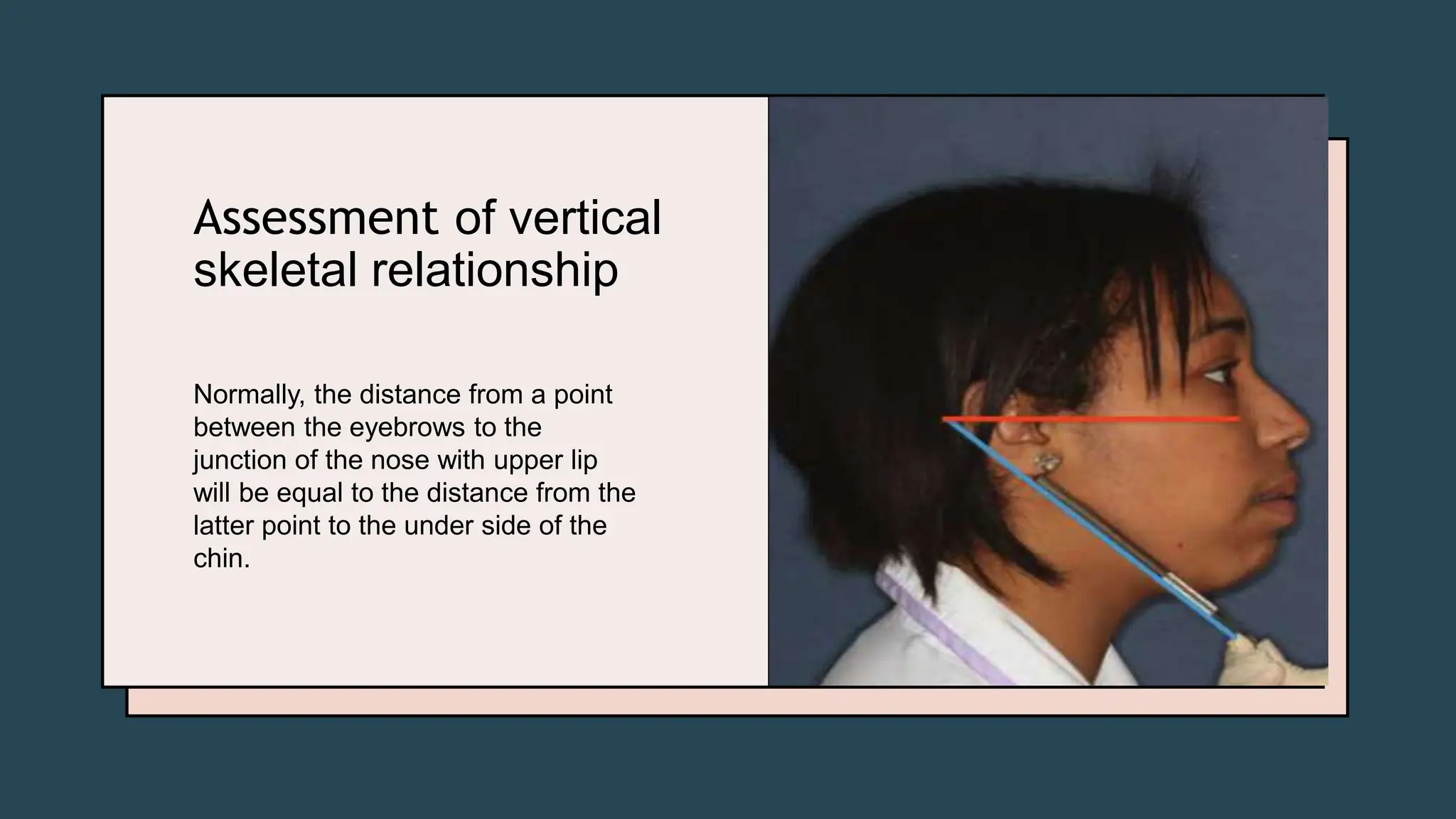 General and extra oral examination orthodontics | PPTX
