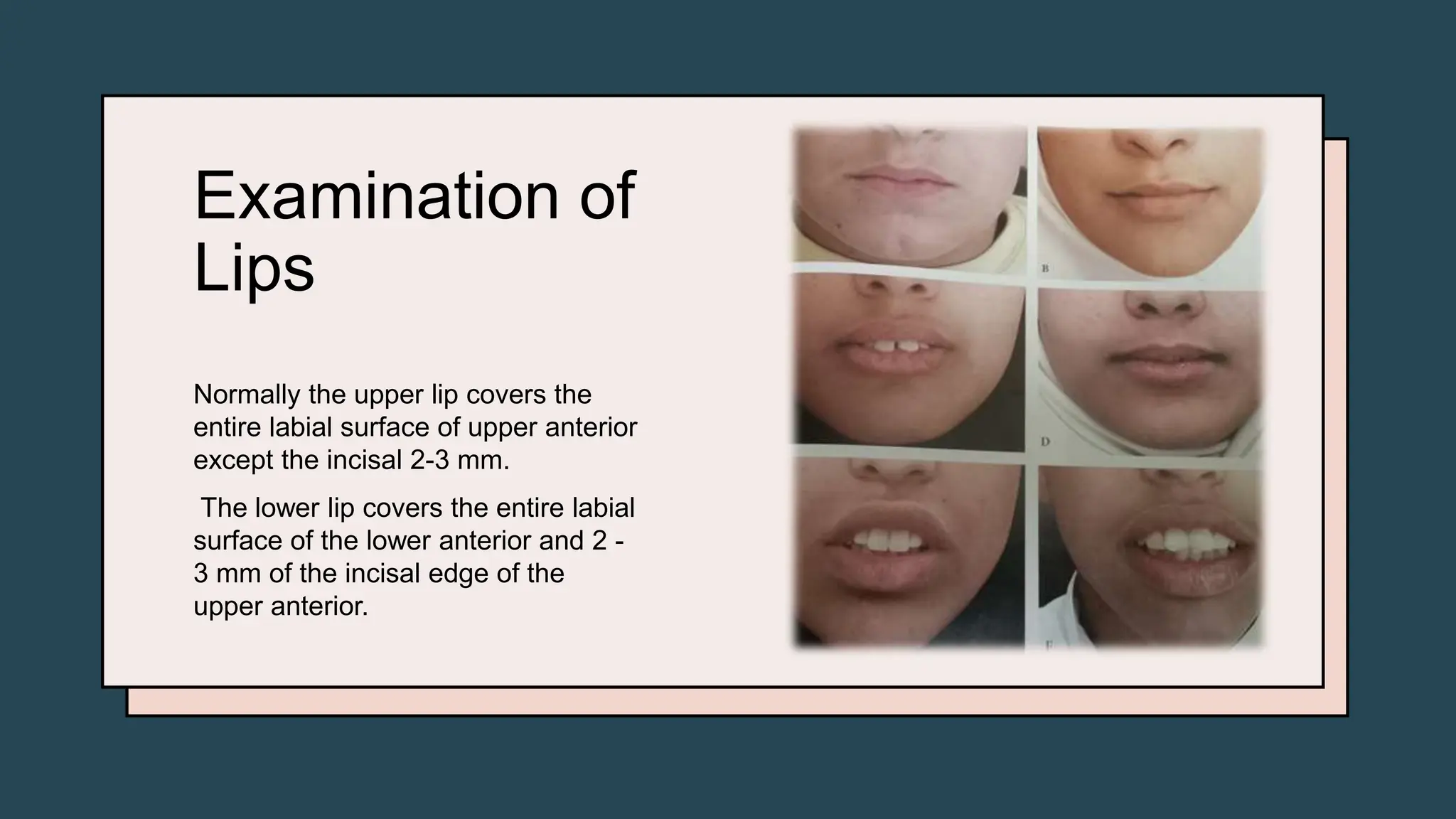 General and extra oral examination orthodontics | PPTX