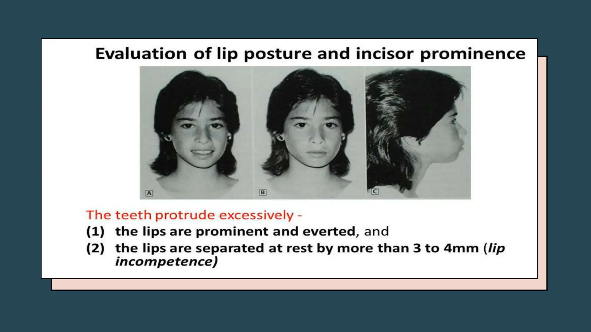 General and extra oral examination orthodontics | PPTX