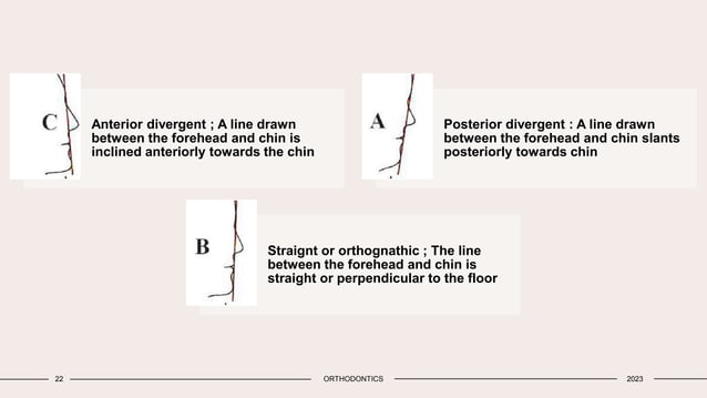General and extra oral examination orthodontics | PPTX | Dental Health ...