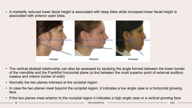 General and extra oral examination orthodontics | PPTX | Dental Health ...