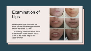 General and extra oral examination orthodontics | PPTX