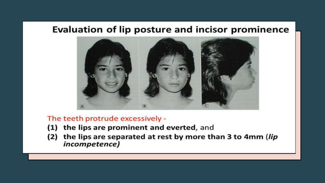 General and extra oral examination orthodontics | PPTX | Dental Health ...