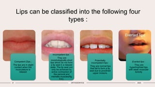 General and extra oral examination orthodontics | PPTX
