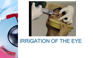 General eye procedures | PPT