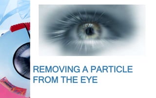 General eye procedures | PPT