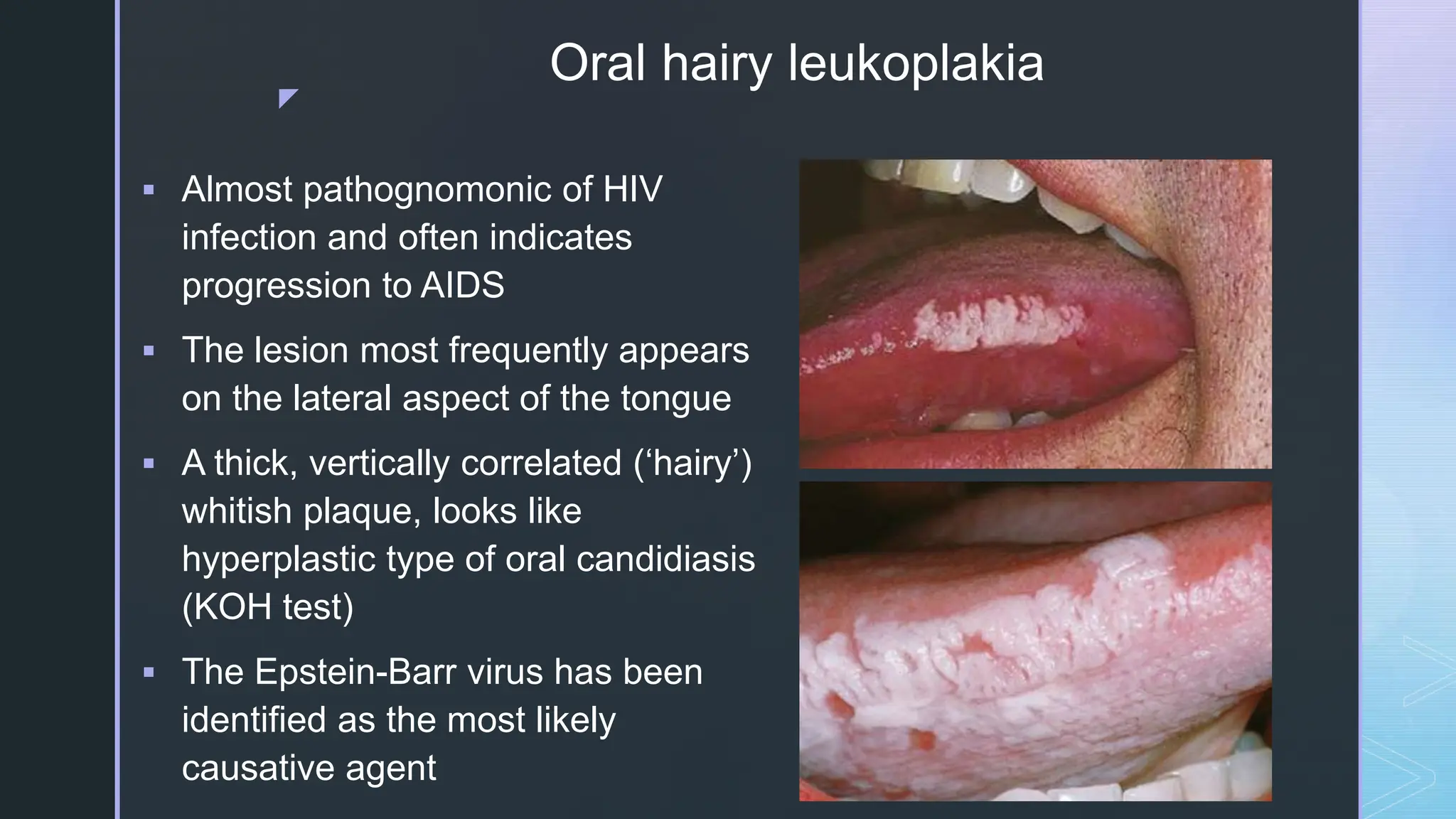 General_HIVandENT.pptx GENERAL HIV AND ENT | PPTX