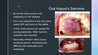 General_HIVandENT.pptx GENERAL HIV AND ENT | PPTX