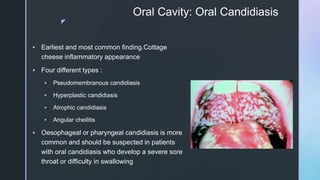 General_HIVandENT.pptx GENERAL HIV AND ENT | PPTX