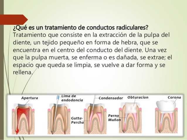 Generalidades de endodoncia