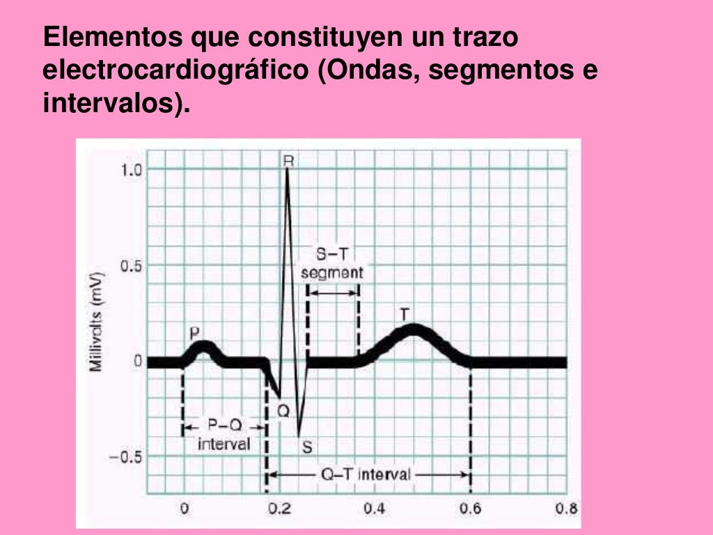 Generalidades del ELECTROCADIOGRAMA, todo lo que debes saber
