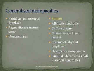 Generalised radiopacities /prosthodontic courses | PPTX