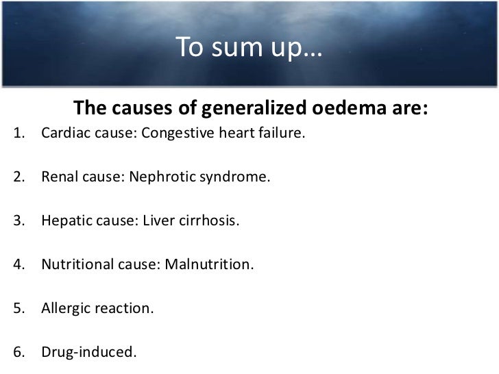 Generalized Edema Generalized And Localized Edema: A Clinical