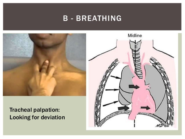 General management of trauma