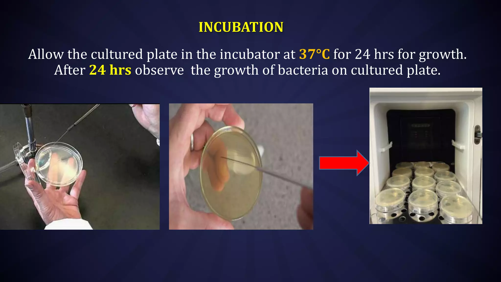 Microorganisms Cultivation Isolationpurification And Characterization