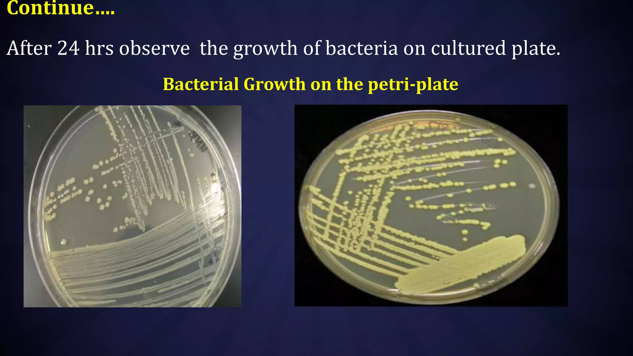 Microorganisms Cultivation Isolationpurification And Characterization