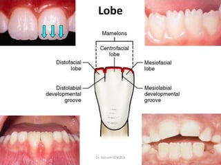 General oral and dental anatomy | PPT