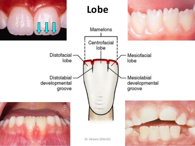 General oral and dental anatomy