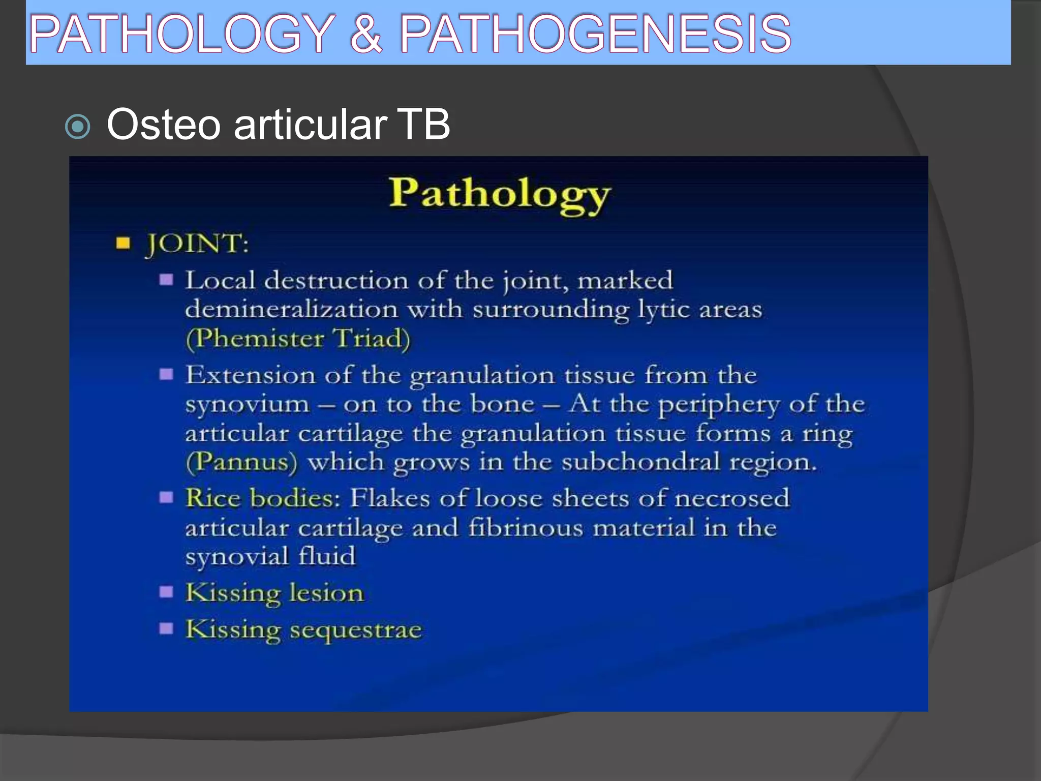 General outline of musculoskeletal tuberculosis by dr ashutosh | PPTX ...