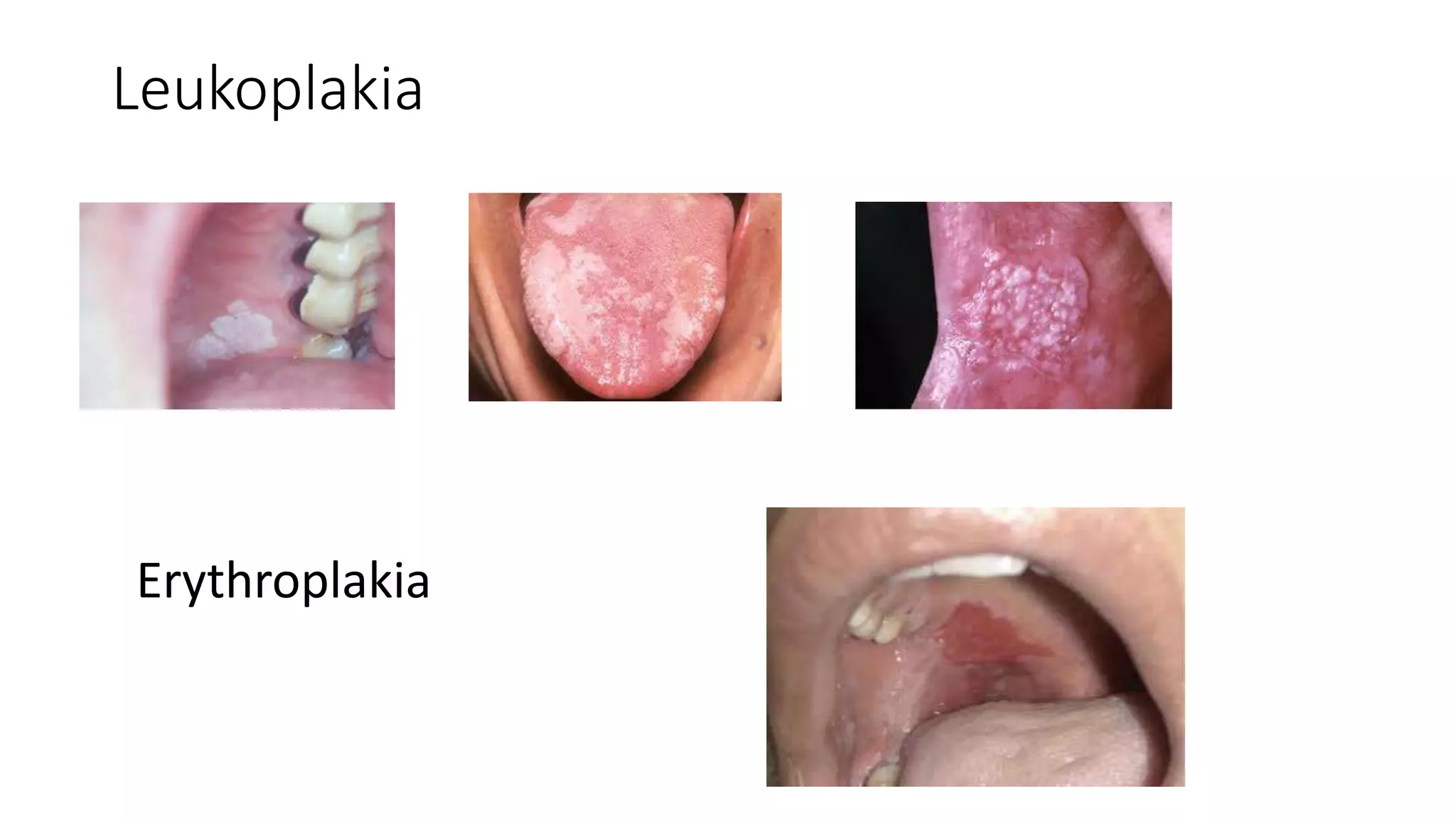 General overview of head and neck cancers | PPTX | Ear, Nose and Throat ...