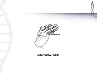 General overview of patterns of transmission of single gene traits | PPT
