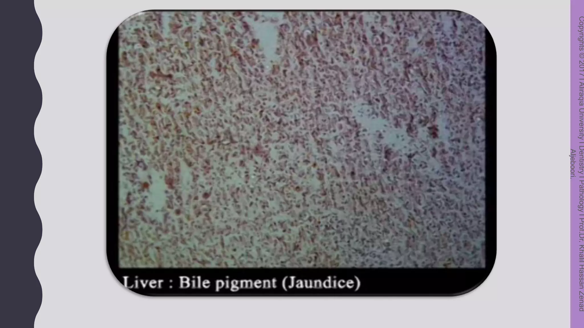 General pathology. slides | PPTX