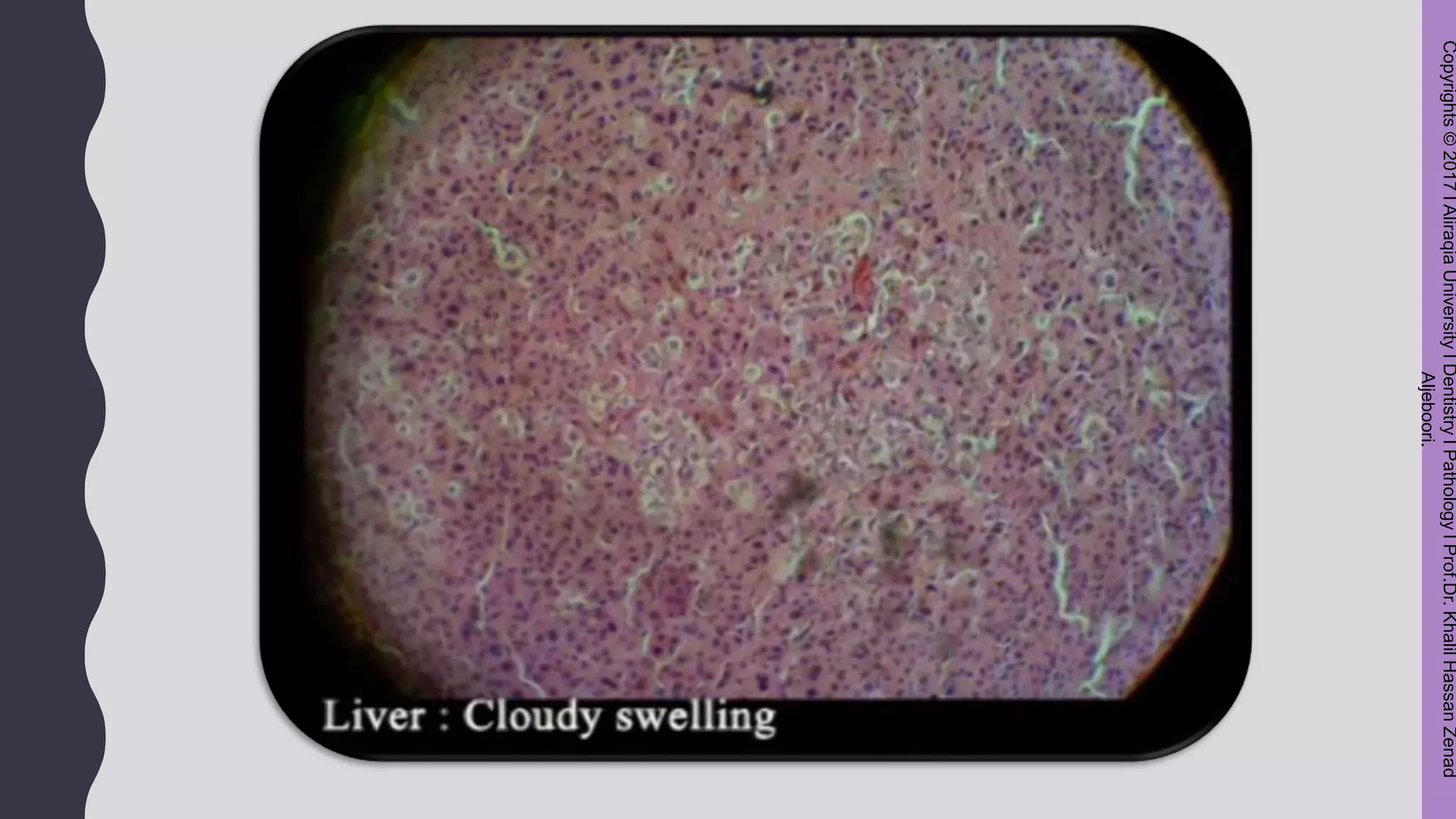 General pathology. slides | PPTX