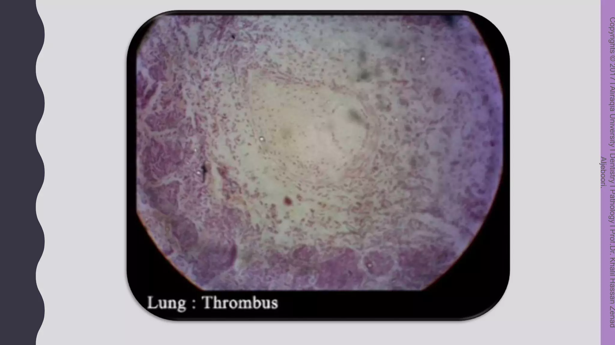 General pathology. slides | PPTX