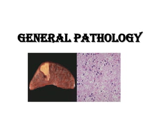 General Pathology.ppt salem f gerbadipathologybadi | PPT