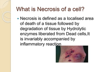 What Causes Necrosis