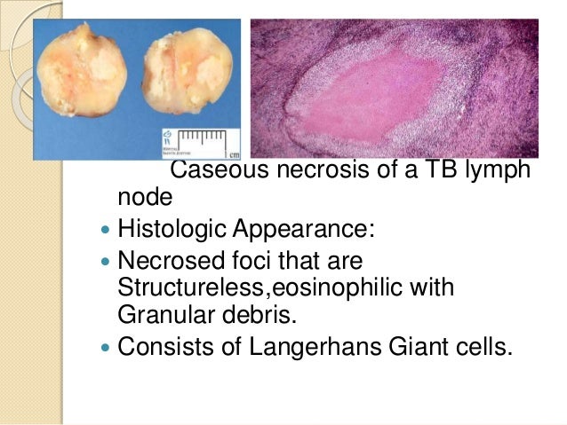 General pathology necrosis