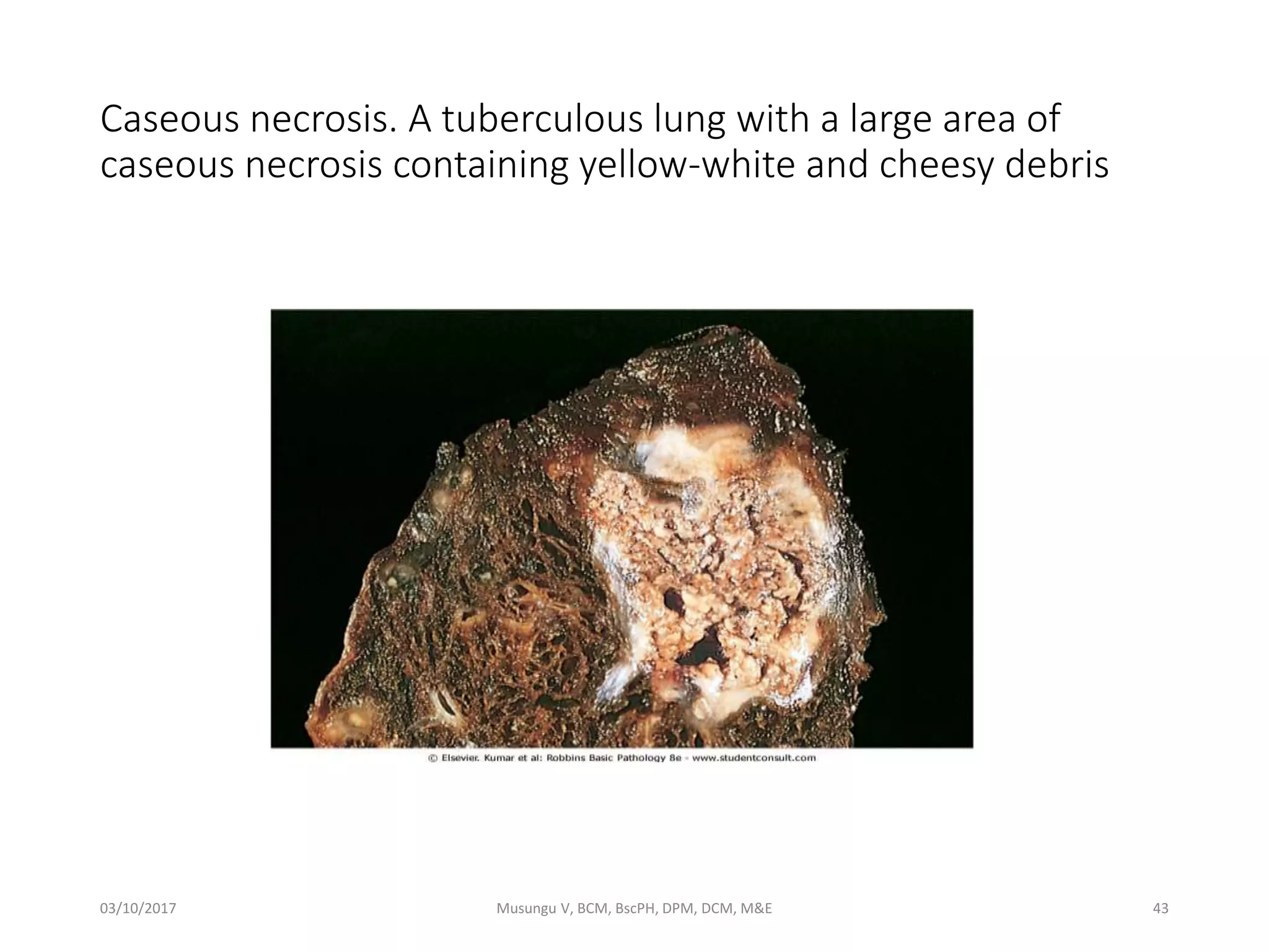 General pathology lecture | PPTX