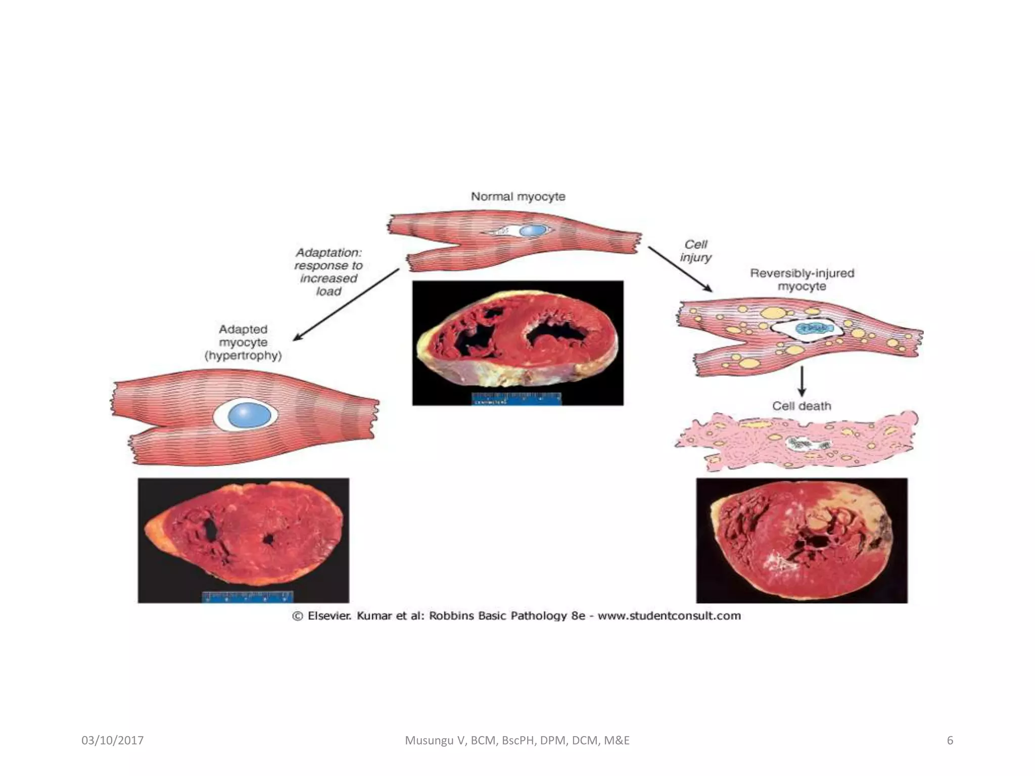 General pathology lecture | PPTX | Heart and Cardiovascular Diseases ...