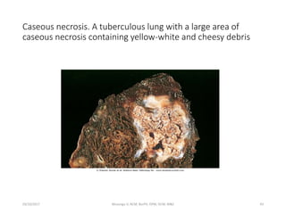 General pathology lecture | PPTX