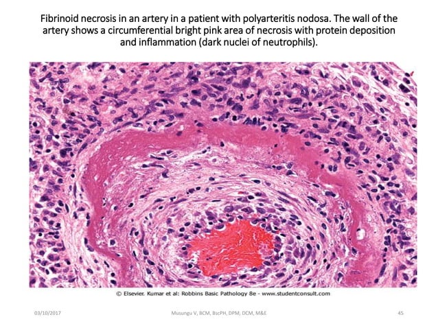 General pathology lecture | PPTX | Heart and Cardiovascular Diseases ...