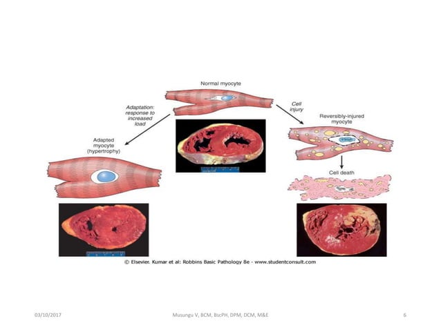 General pathology lecture | PPTX | Heart and Cardiovascular Diseases ...