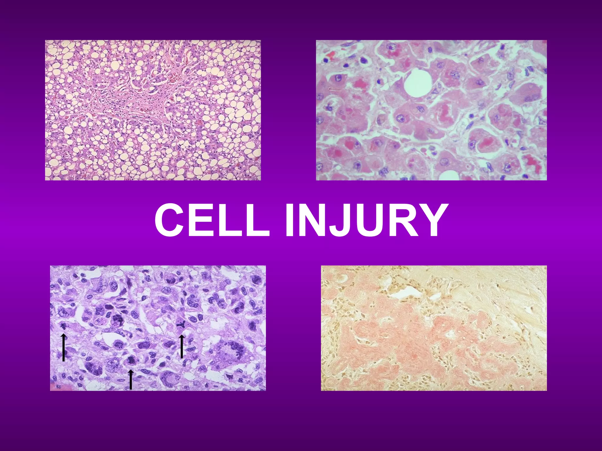 General pathology lecture 1 introduction & cell injury | PPT