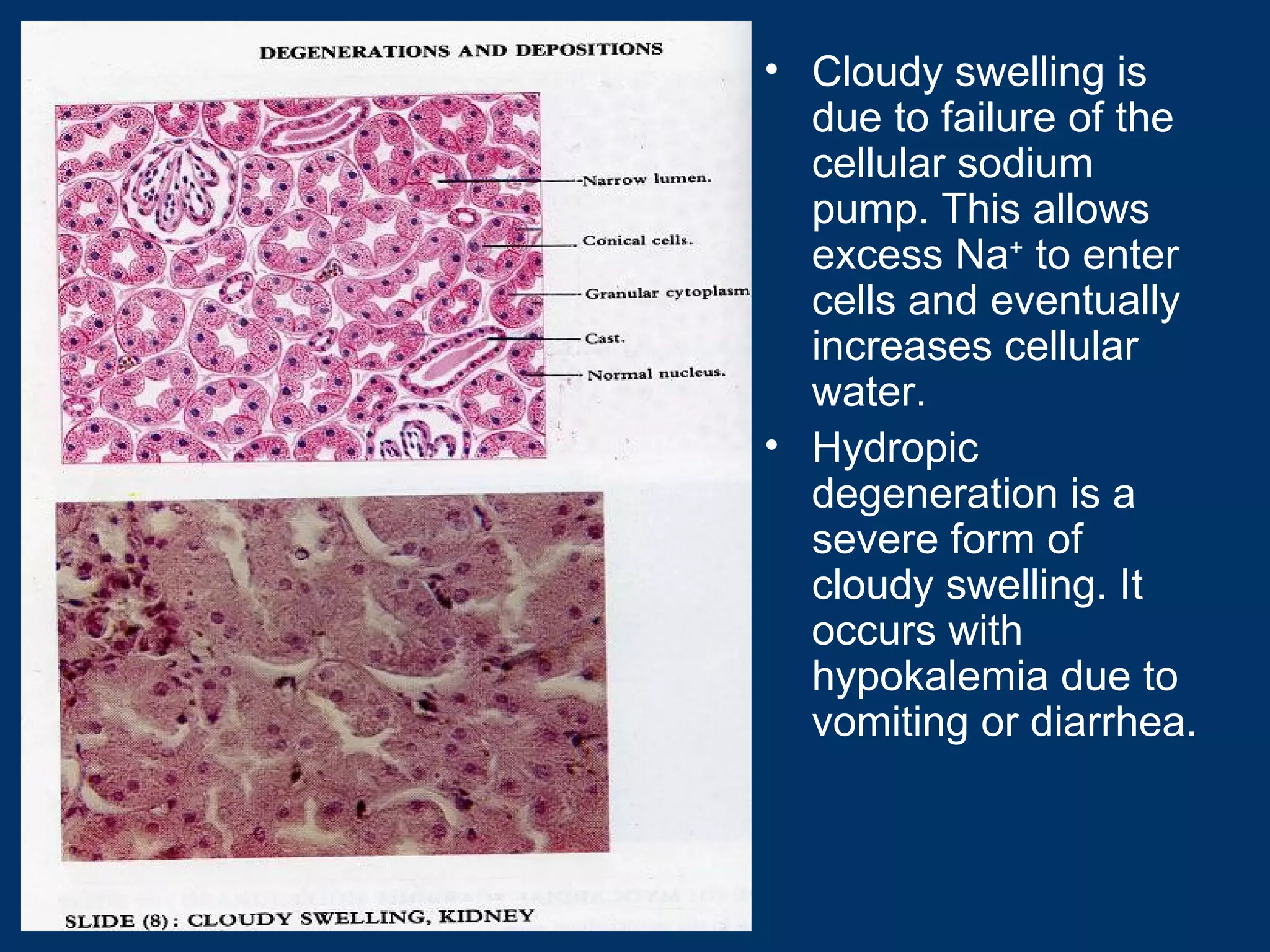 General pathology lecture 1 introduction & cell injury | PPT