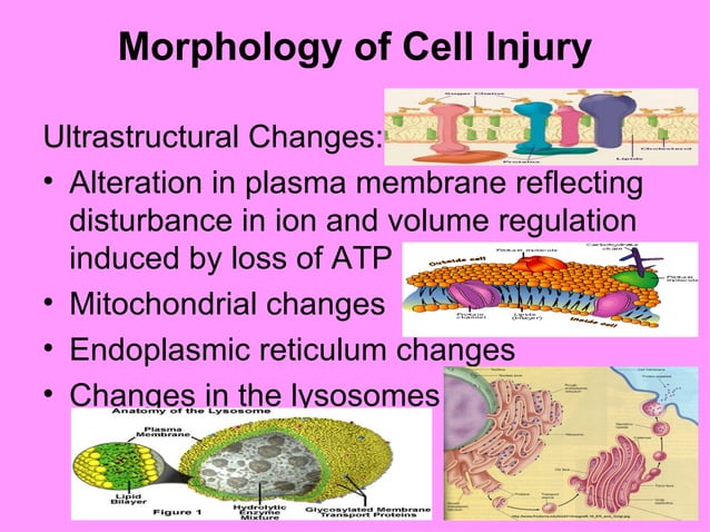 General pathology lecture 1 introduction & cell injury